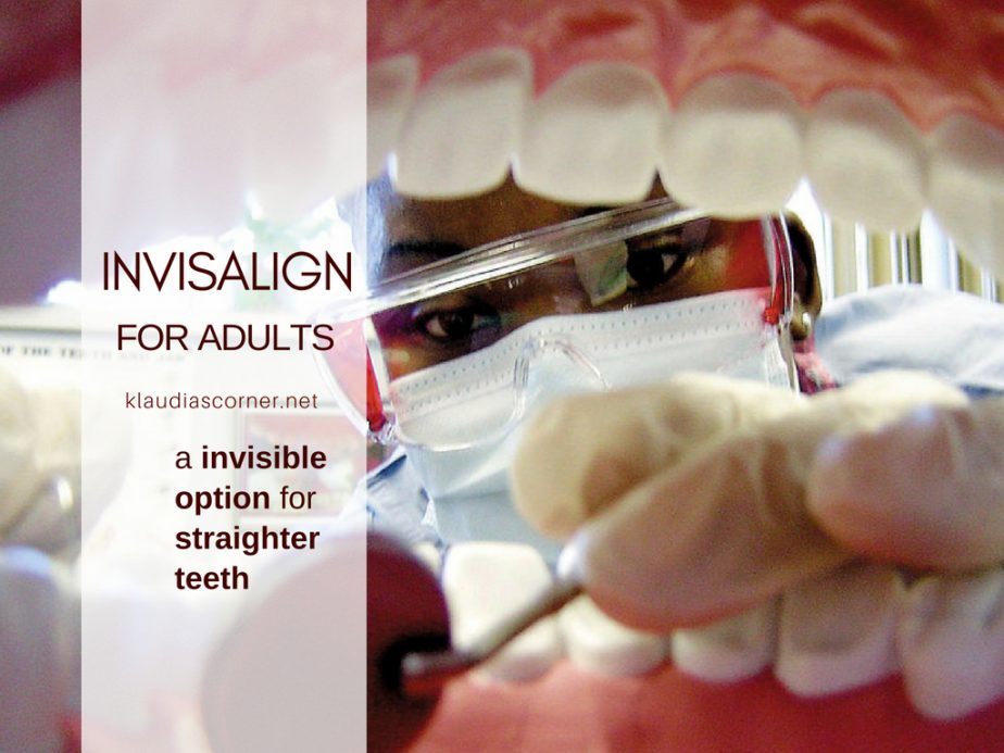 Invisalign For Adults For Straighter Teeth | Klaudia's Corner